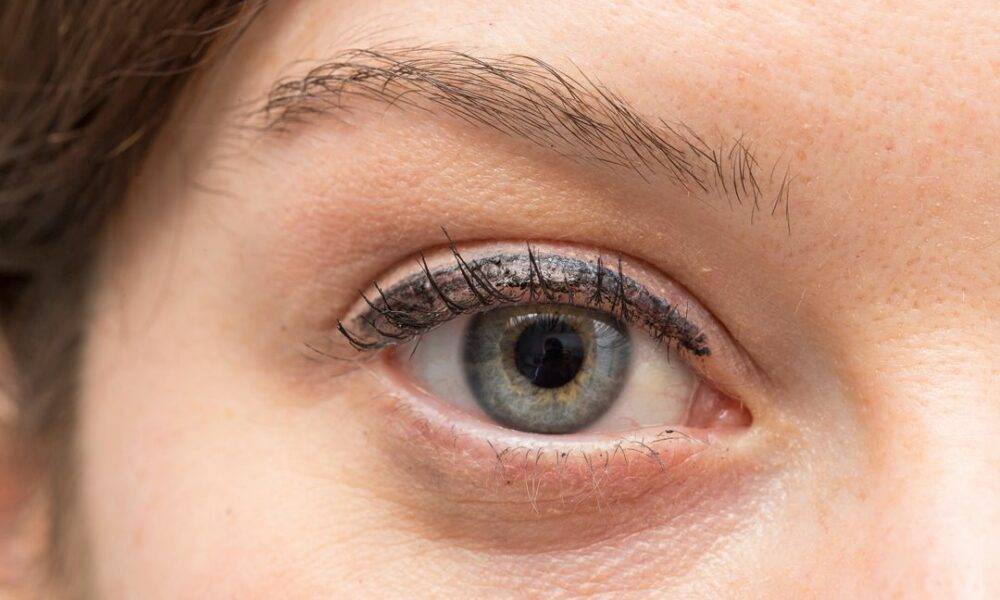 Metode naturale care te scapă de cearcăne – Monden