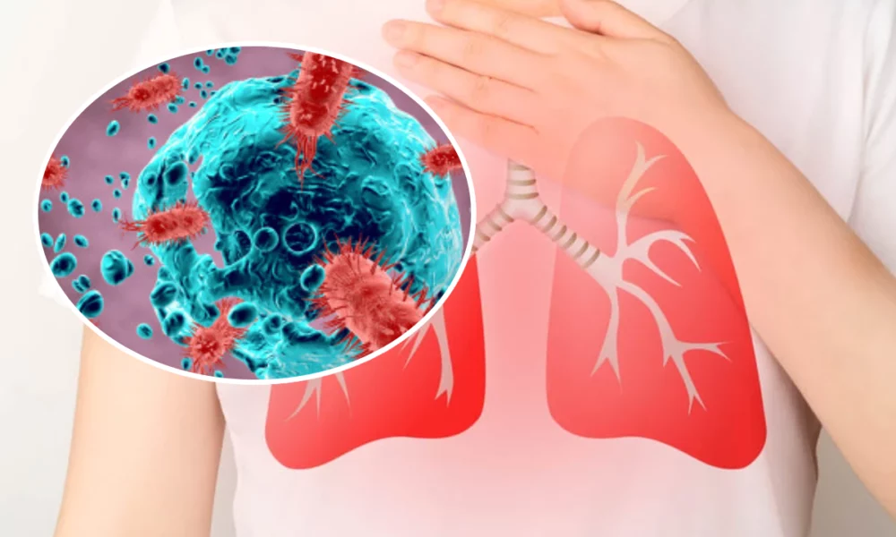 Alertă de sănătate! Boală extrem de contagioasă din 1990 diagnosticată ...